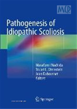 Pathogenesis of Idiopathic Scoliosis 1st Editon 2019 Softbound ...