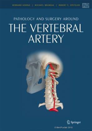 Pathology and surgery around the vertebral artery 1st Editon 2013 ...