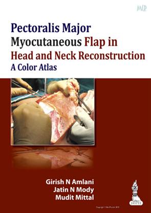 Pectoralis Major Myocutaneous Flap In Head And Neck Reconstruction A ...