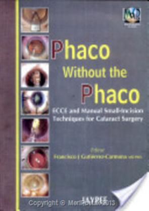 Phaco Without The Phaco Ecce & Manual Small Incision Tech.For Cata.Surg ...