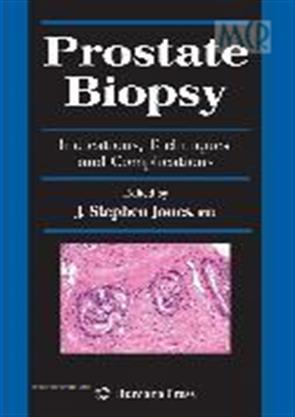 Prostate Biopsy Indications Techniques and Complications 1st Editon ...