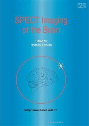 SPECT Imaging of the Brain 1st Editon 2012 Softbound, Radiology Books ...