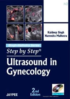 Step By Step Ultrasound In Gynecology With Photo Cd-Rom Singh-Malhotra ...