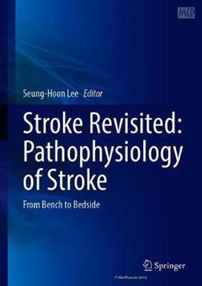 Stroke Revisited Pathophysiology of Stroke From Bench to Bedside 2020 ...