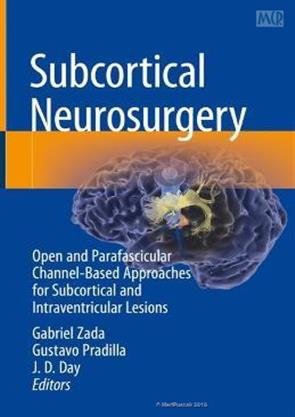 Subcortical Neurosurgery Open and Parafascicular Channel Based ...