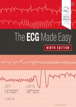 The ECG Made Easy 9th Edition by Hampton, John Hampton, 9780702074660 ...
