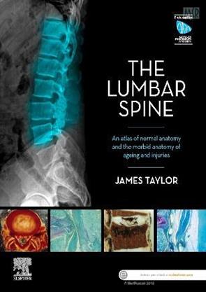 The Lumbar Spine An Atlas Of Normal Anatomy And The Morbid Anatomy Of ...