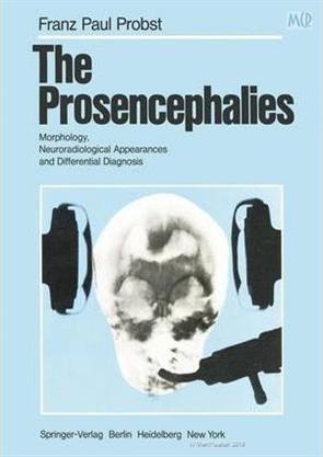 The Prosencephalies Morphology Neuroradiological Appearances and ...