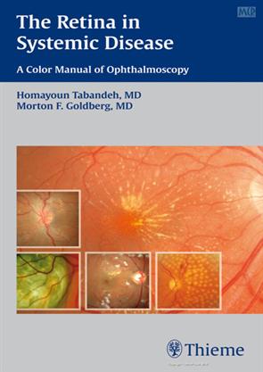 The Retina In Systemic Disease A Color Manual Of Ophthalmoscopy 1St ...