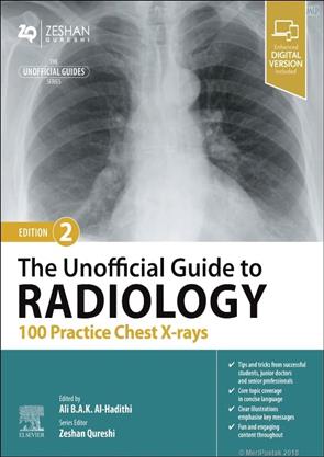 The Unofficial Guide To Radiology 100 Practice Chest X Rays With Access ...