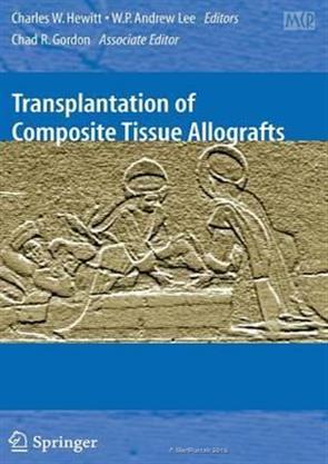 Transplantation Of Composite Tissue Allografts (Hb), Immunology ...