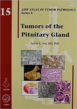 Tumors Of The Pituitary Gland : Tumor Pathology Series (11 To 24), Pathology Books, Armed Forces ...