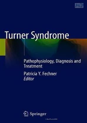Turner Syndrome Pathophysiology Diagnosis and Treatment 1st Editon 2020 ...