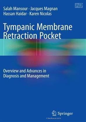 Tympanic Membrane Retraction Pocket Overview and Advances in Diagnosis ...