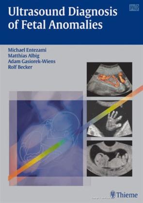 Ultrasound Diagnosis Of Fetal Anomalies, Radiology Books, Thieme ...