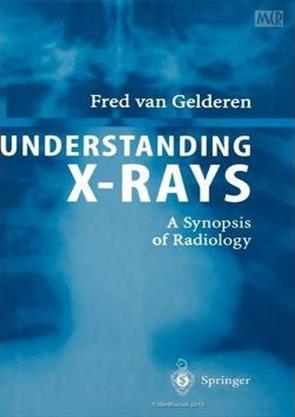 Understanding X-Rays A Synopsis of Radiology 1st Editon 2004 Hardbound ...